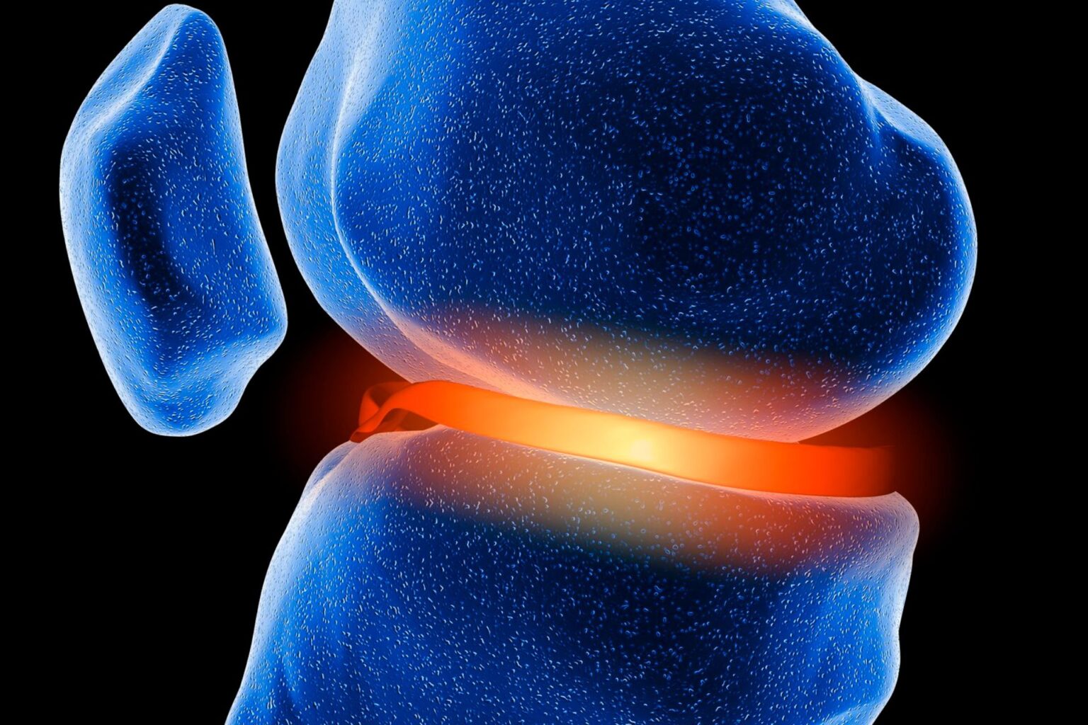 Finding Relief with Medial Meniscus Tear Treatment