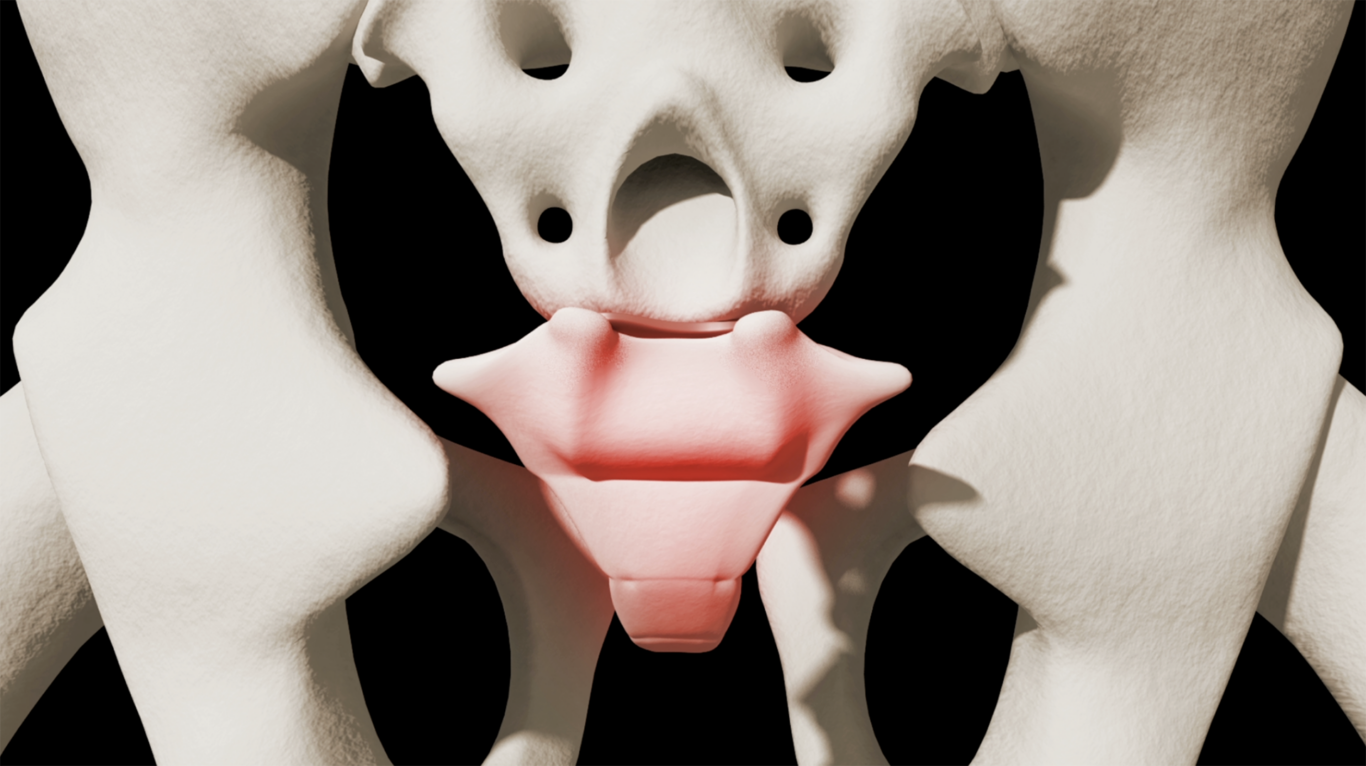 How to Cure Tailbone Pain: Effective Treatments for Coccydynia